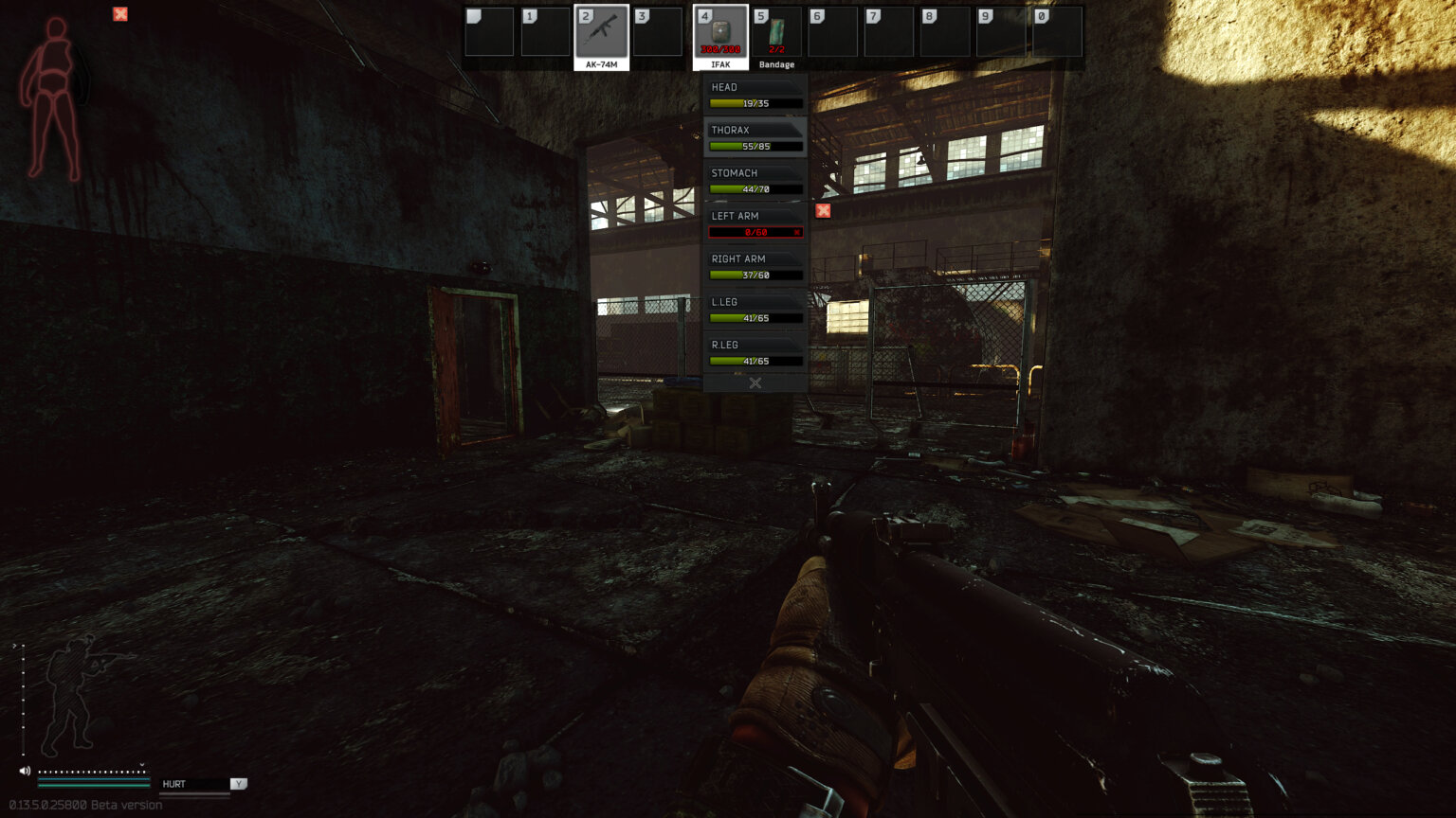 Escape from Tarkov - How to use the new healing system - Survival ...